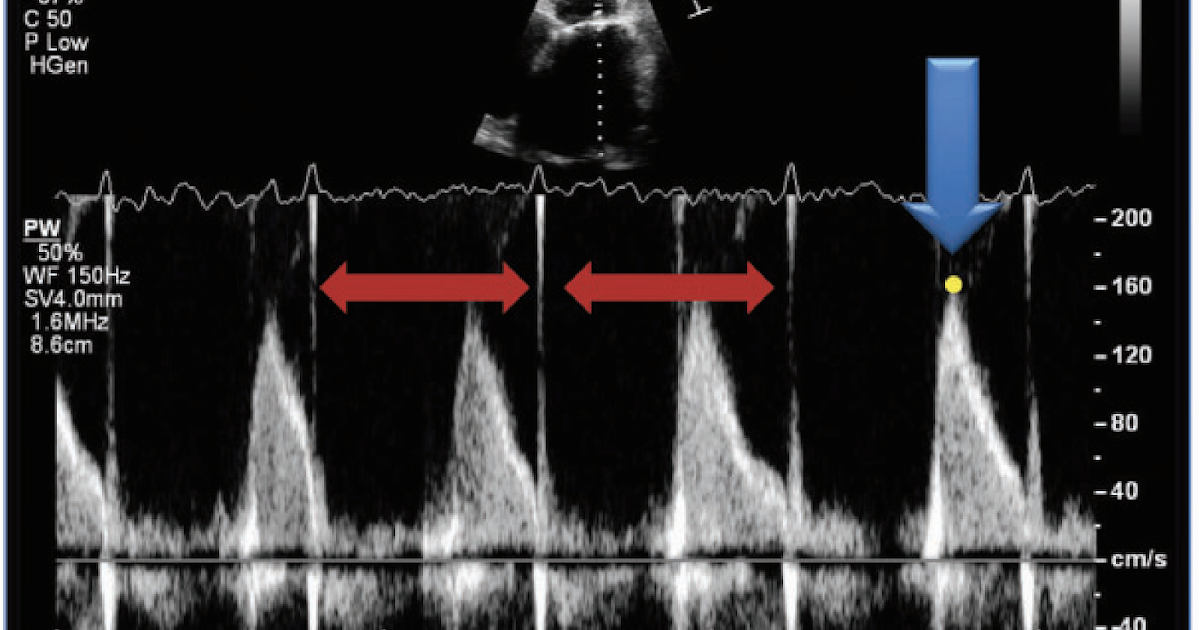 松下 ER ランチ・カンファレンス: Index beat