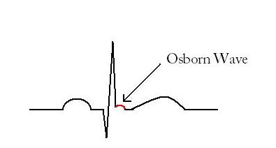 J.A.M.B-ing: The Camel Hump