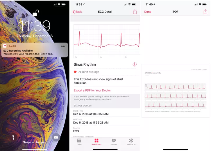Apple Watch Series 4: The Setup of ECG app
