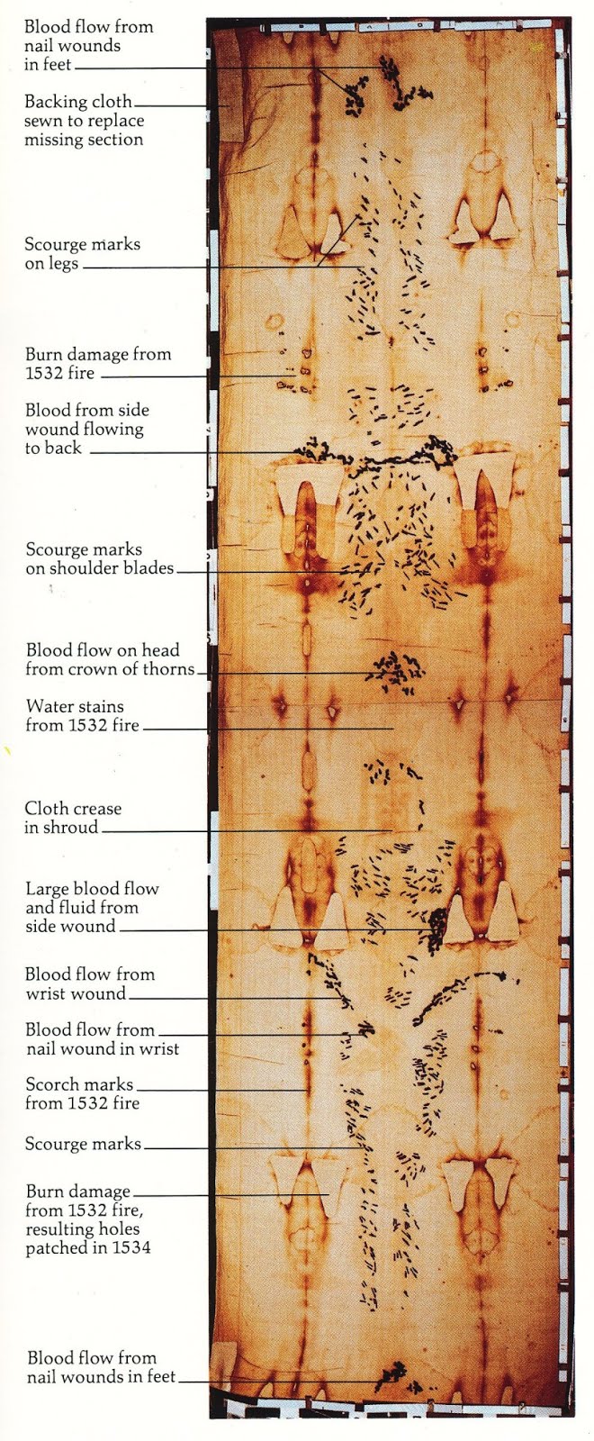 The Shroud of Turin: The Shroud of Turin: 2.4. The wounds