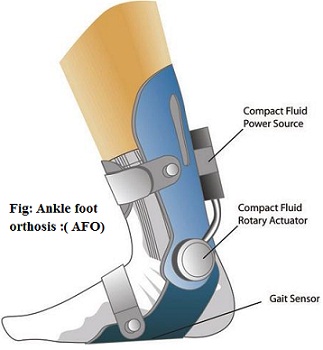 Ankle foot orthosis :( AFO)