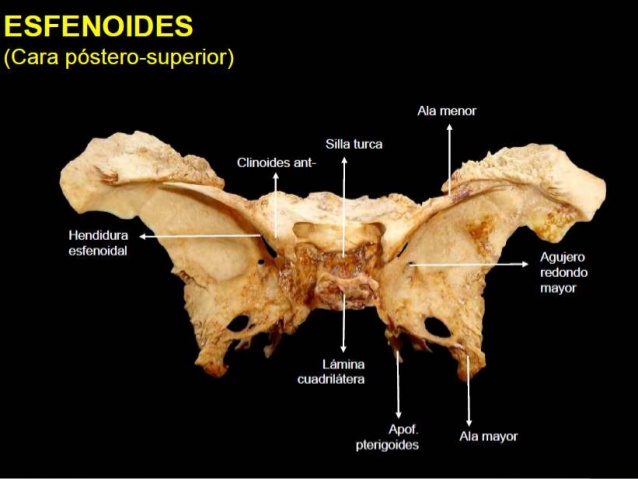 ANATOMÍA: Tejido óseo. EL CRÁNEO. TC, TAC, Rx, RADIOGRAFÍA.