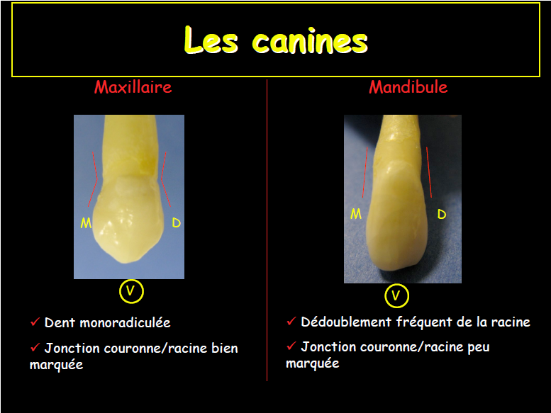 Dental ebooks: Anatomie dentaire : Les canines