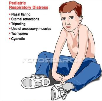RESPIRATORY DISTRESS | MEDICAL TODAY