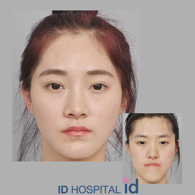 ID Hospital Korea: [ID Hospital Review] What is the solution for a long ...