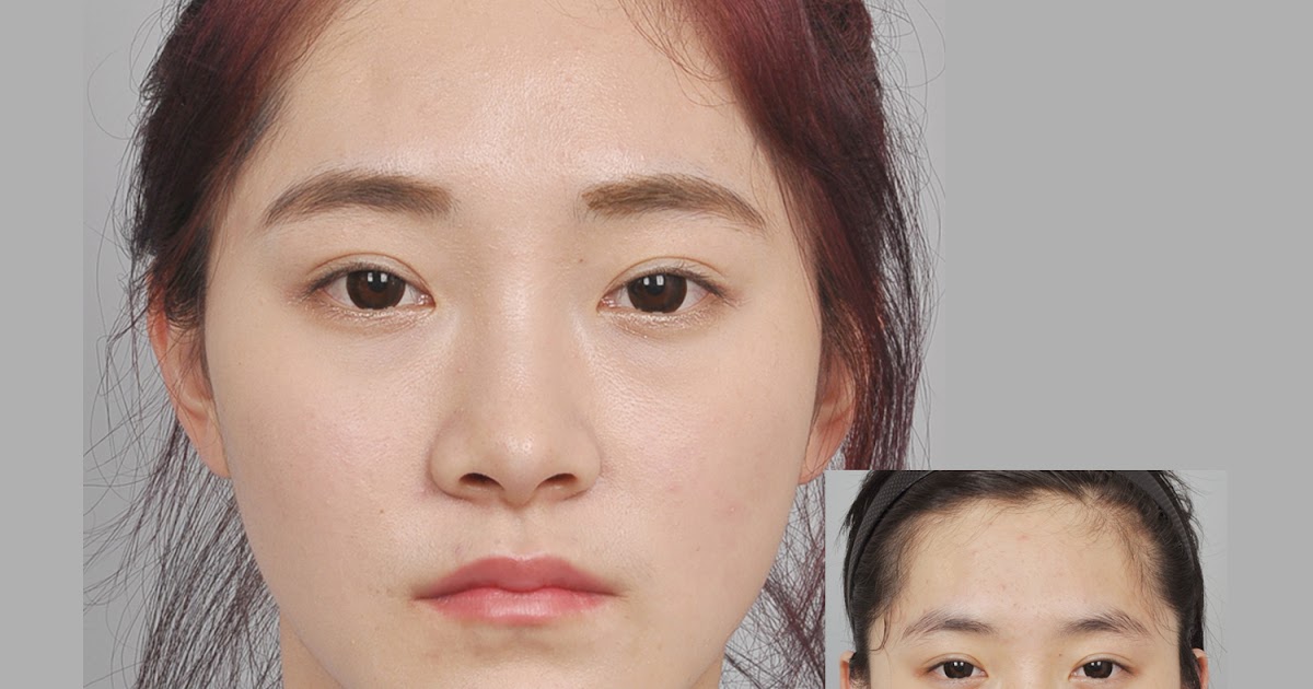 ID Hospital Korea: [ID Hospital Review] What is the solution for a long ...