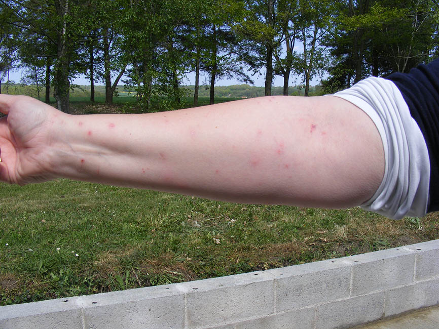 Days on the Claise: Pine Processionary