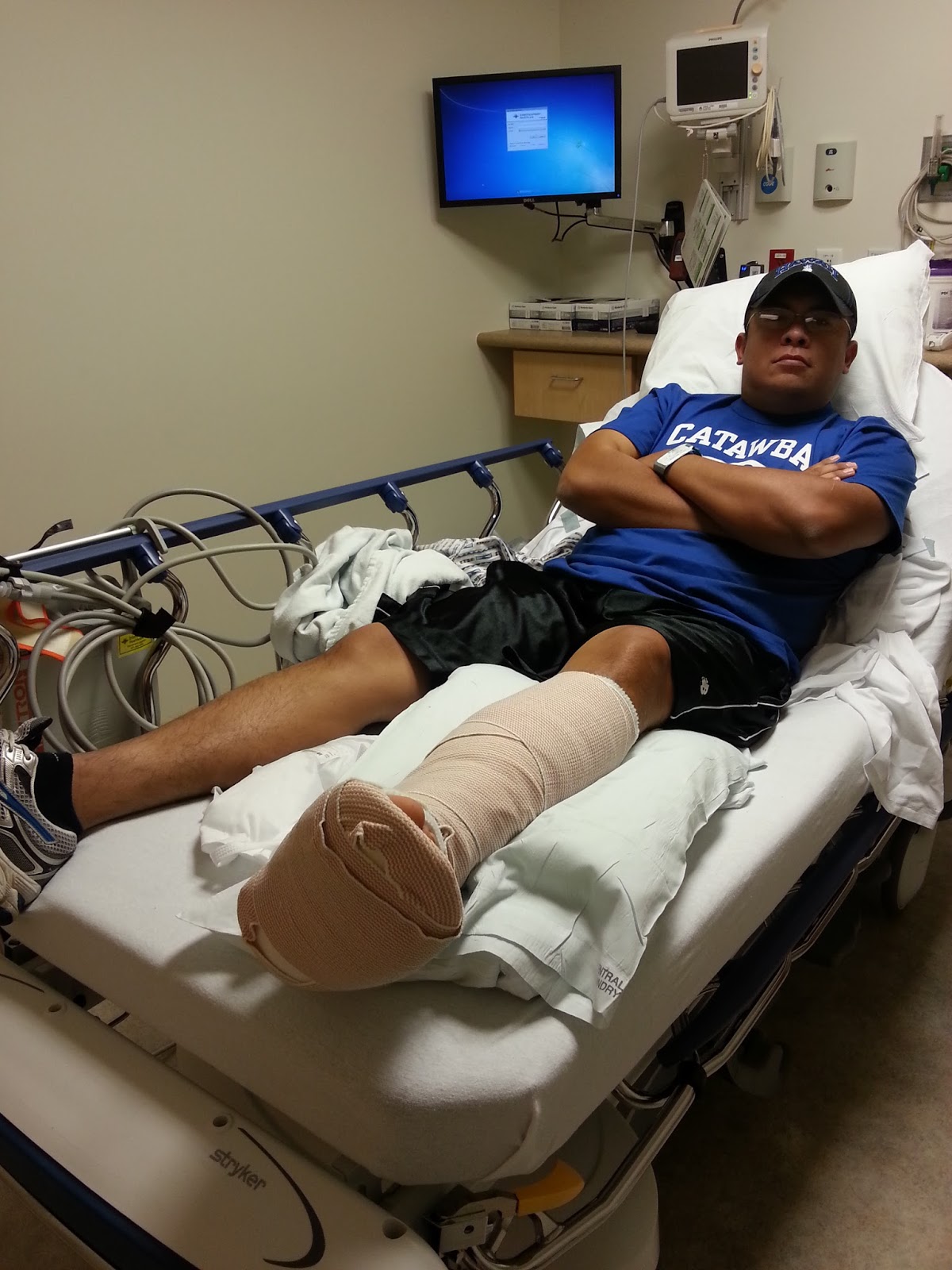 Peroneal Tendon Surgery Recovery: Surgery Day, 8-19
