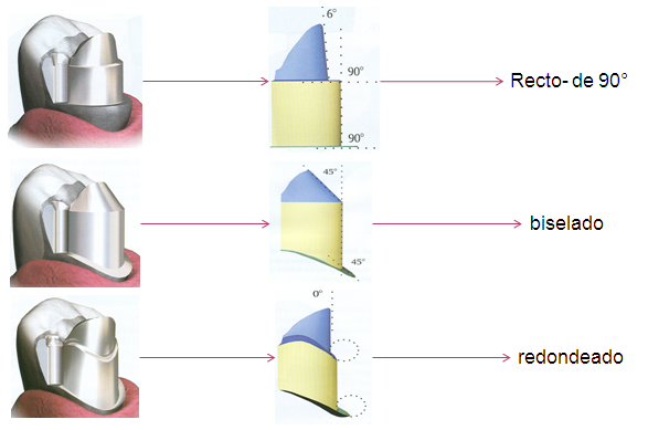 Microfresado Dental: noviembre 2013