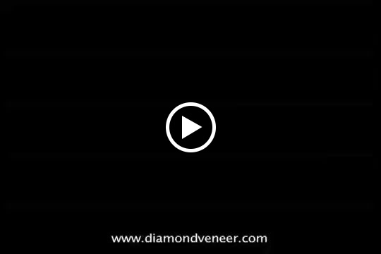 Diamond Veneer - simulated diamonds affordable wedding jewelry ...
