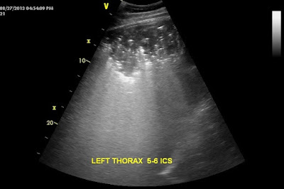 Teknik Operasi Thoracocentesis pada Hewan (Bedah Thoraks) - Mydokterhewan