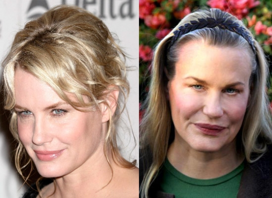 Daryl Hannah Plastic Surgery Before and After Botox, Cheek Implants and ...