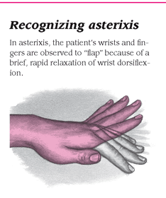 Asterixis Causes Symptoms and Treatment