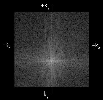 practiCal fMRI: the nuts & bolts: Common persistent EPI artifacts ...