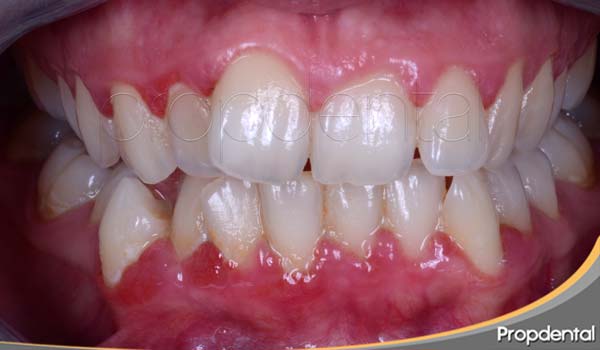 TU VIDA CAMBIA, CON LA ORTODONCIA: 4 PASOS PARA SABER SI NECESITAS BRACKETS