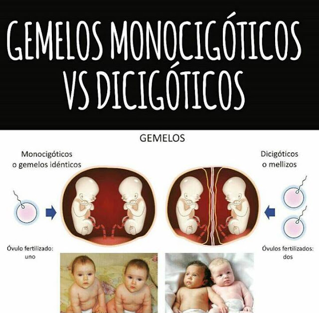 ¿Por qué nacen gemelos? ¿Qué son gemelos idénticos y qué mellizos ...