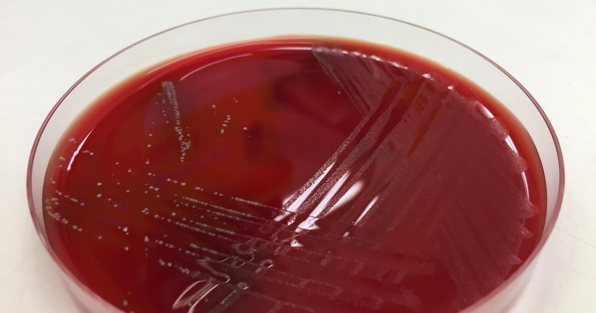 Microbiologylog: A brief description of Eubacterium limosum from Blood ...