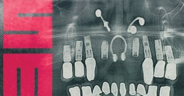 La Encrucijada: Portada y tracklist de SURGICAL METH MACHINE