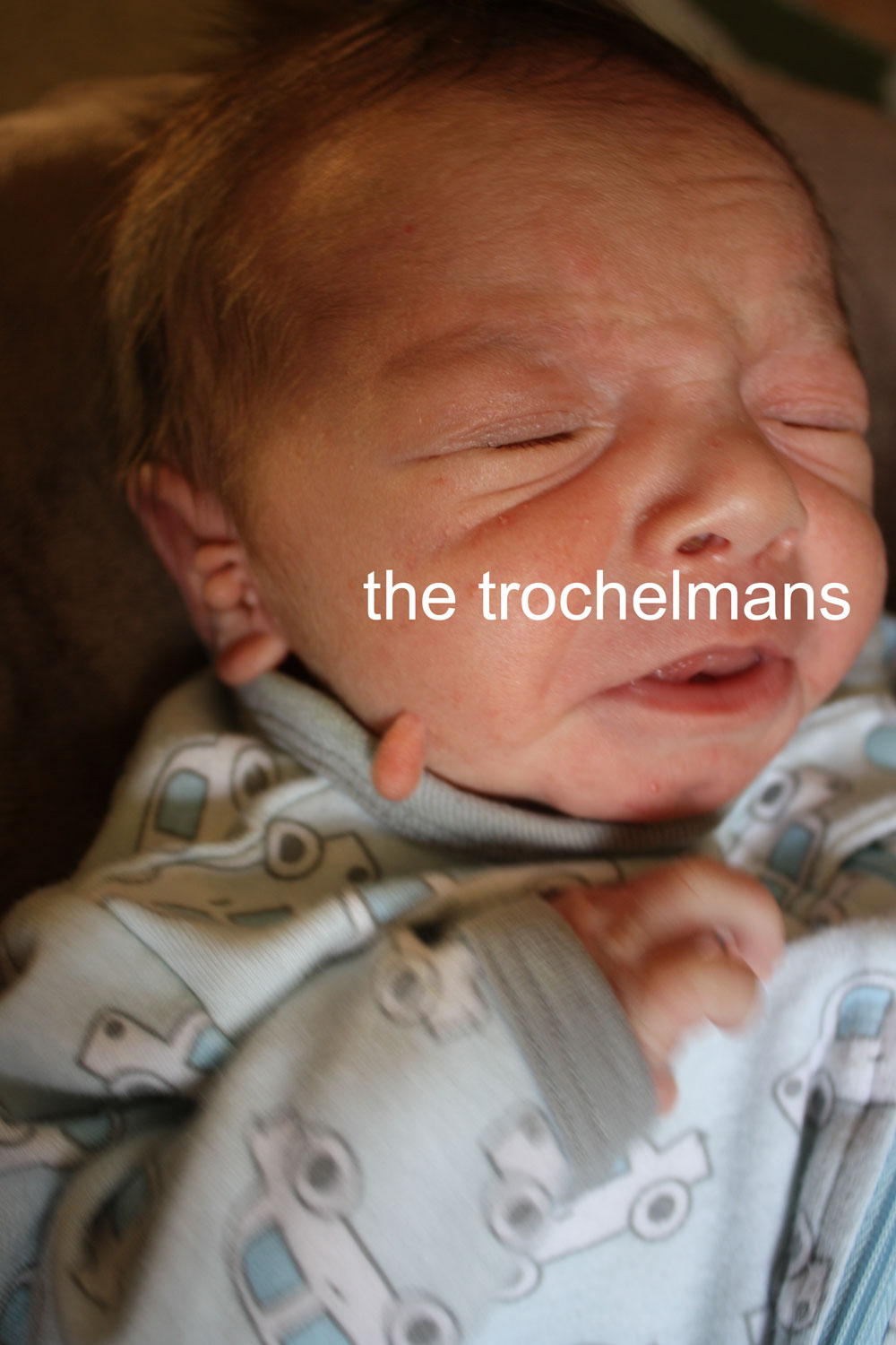 the trochelmans: Skin tag removal on our baby