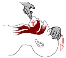 PMI TASIK: PERTOLONGAN PERTAMA BAG. 4 : BHD (BANTUAN HIDUP DASAR) DAN ...