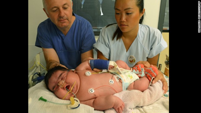 HEAVY BABY WEIGHING 13 POUNDS BORN IN GERMANY ~ simply whats on