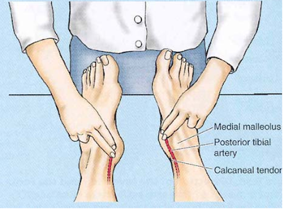 Palpasi Denyut Arteri Ekstremitas ~ Keranjang Artikel