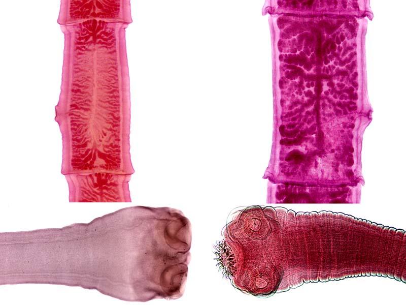 Lecture Notes in Medical Technology: Lecture #5: THE CESTODES OR TAPEWORMS