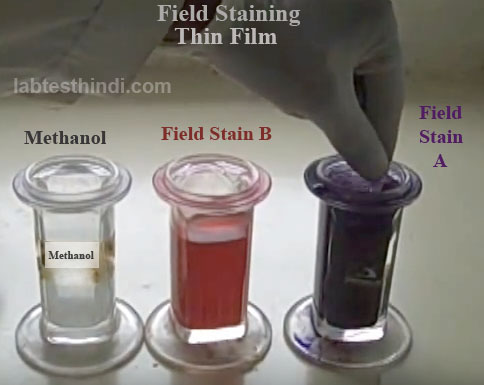 Blood Smear Slide Staining कैसे करते हैं - Field Stain ~ Lab Test Hindi