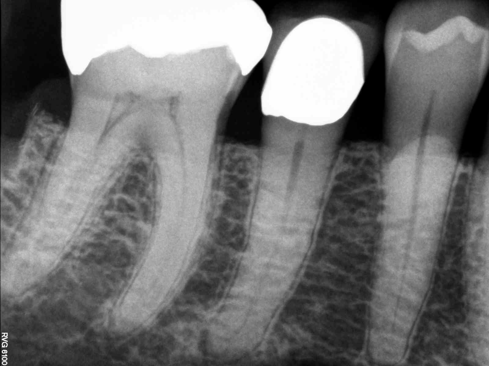 WF 83 - Bauer Smiles