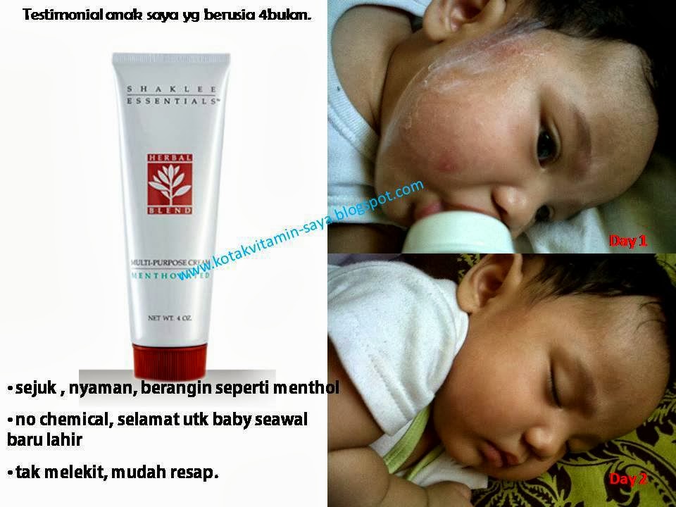 RUAM PANAS DI MUKA ANAK HILANG KEESOKAN HARINYA | Kotak Vitamin Saya