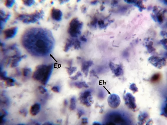 Fun With Microbiology (What's Buggin' You?): Entamoeba polecki