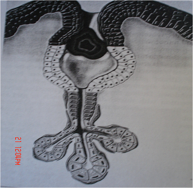 Dentistry and Medicine: Notes on Sialolithiasis-Clinical features ...