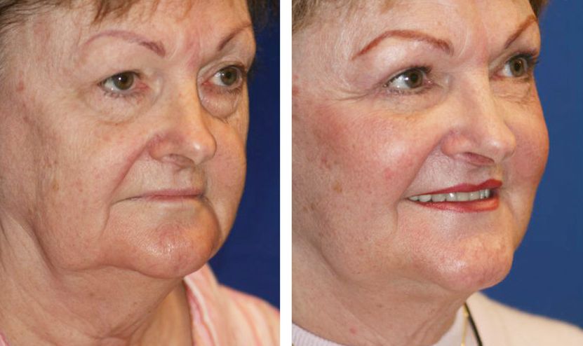 Get An Oriental Home Facelift Via Face Toning Workouts Do Face Toning Exercises Really Work For