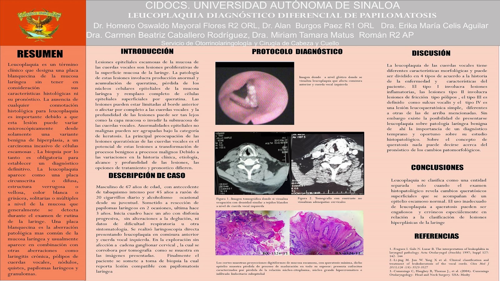 Portafolio Homero Mayoral: Poster Papilomatosis Laringea