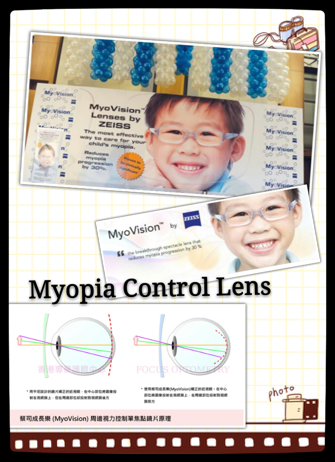 眼睛会说话: 近视矫控镜(Myopia Control Lens)~MyoVision (Carl Zeiss)