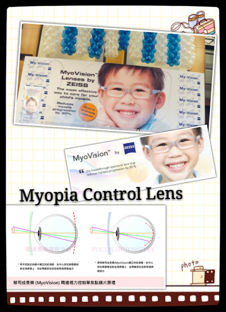 眼睛会说话: 近视矫控镜(Myopia Control Lens)~MyoVision (Carl Zeiss)
