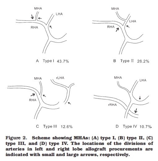 The Pump and the Tubes: Middle Hepatic Artery