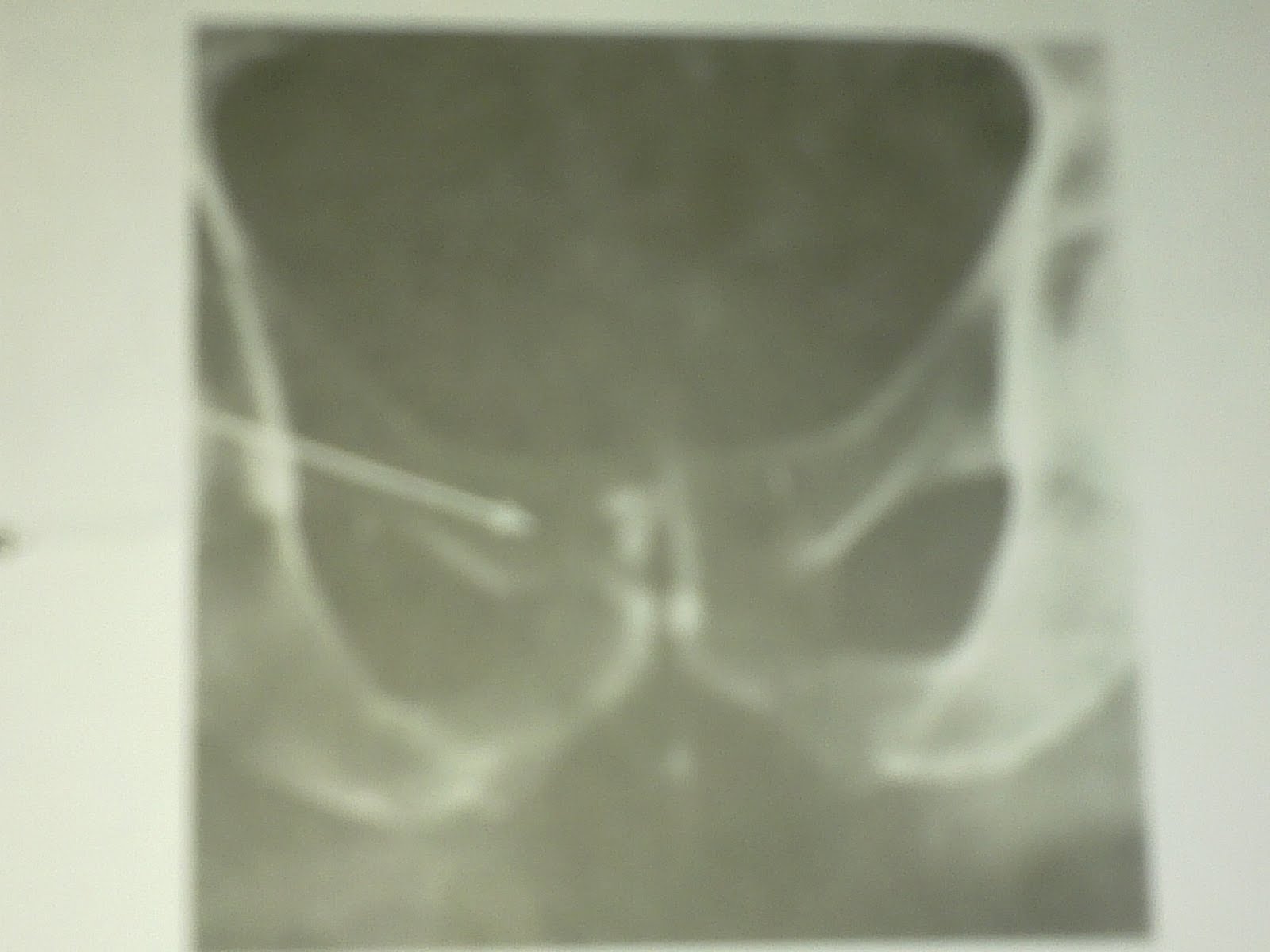 ChyntiaBlog: Radiologi Abdomen dan Urogenital