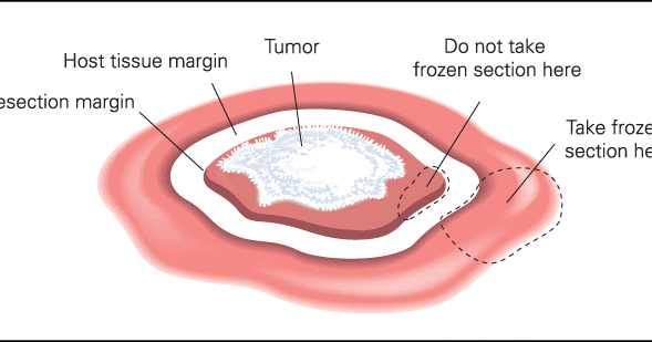 Principles of Frozen Section Specimens