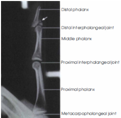 Study of digits (second through fifth) | Radiology