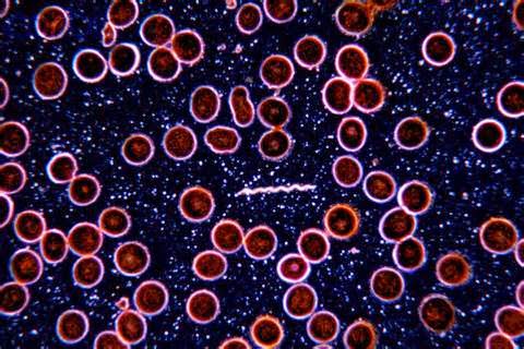 The Complexities of Lyme Disease (Part 2): Motility of the Lyme ...