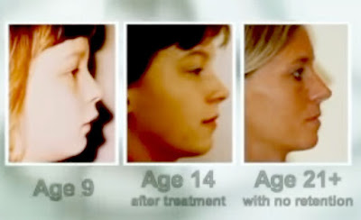 ORTHODONTIC: The Orthotropic method strives to guide facial growth ...