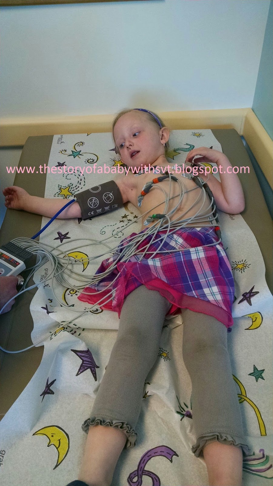 The Story of a Baby with SVT(PJRT): August 2016