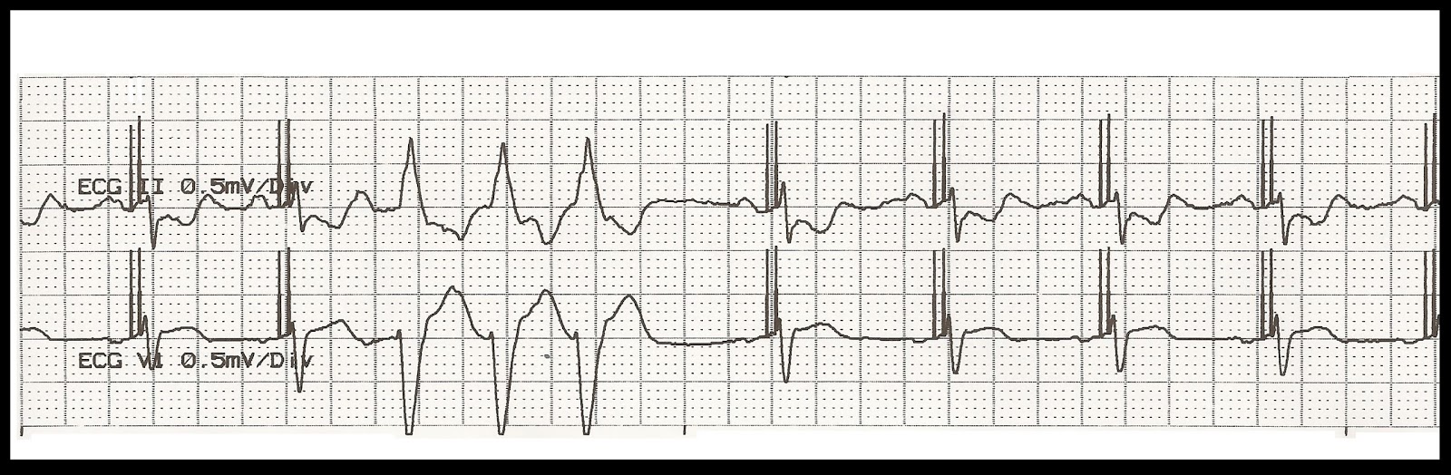 EKG Quiz 320