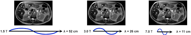 Radiology Community: Dielectric shading artifacts in high field ...