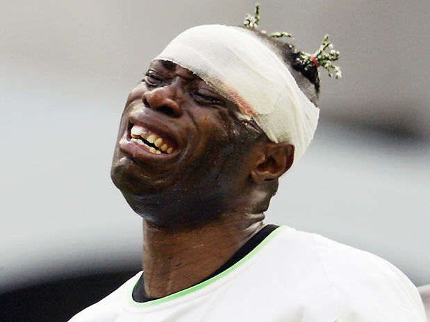 Os 10 jogadores mais feios da história das Copas ~ Melancia Atómica