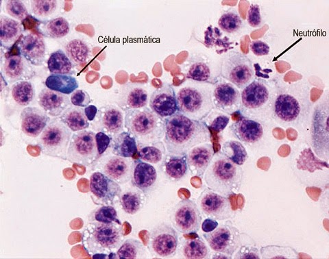 Capacitación 5 "D" (Bitácora) : Tinción de Wright