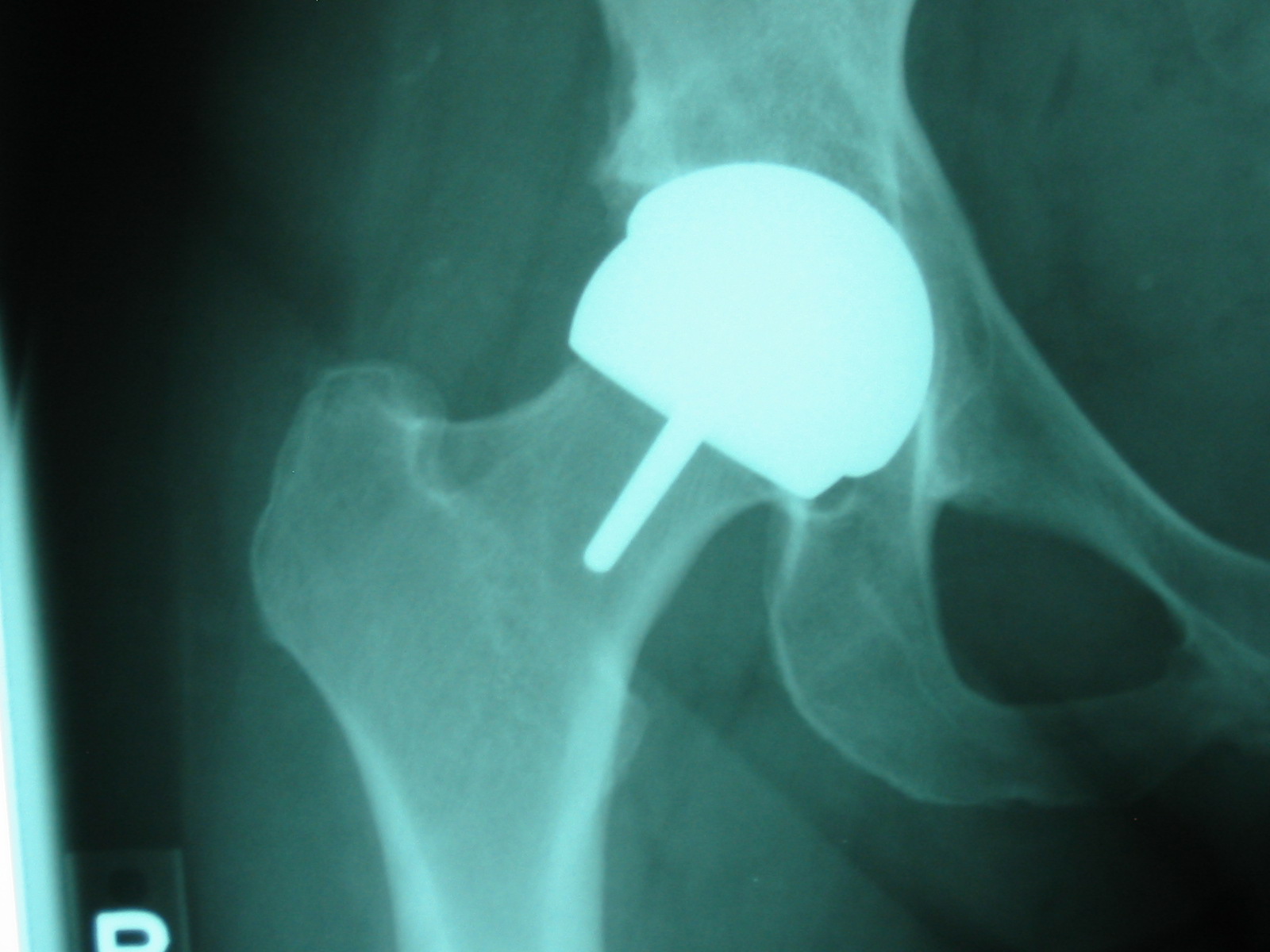 Great Divide Mountain Bike Route