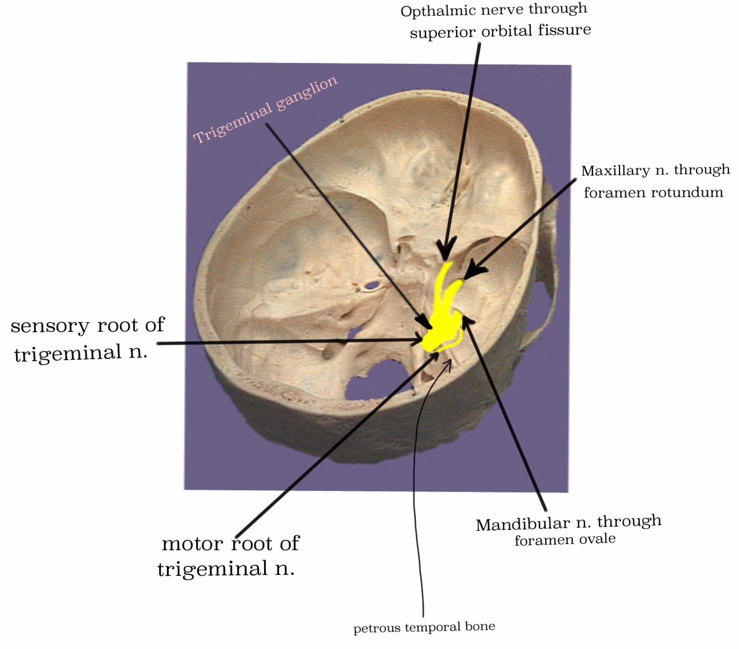 A Tale of Med Students: Trigeminal Nerve - Cranial Nerve V/5