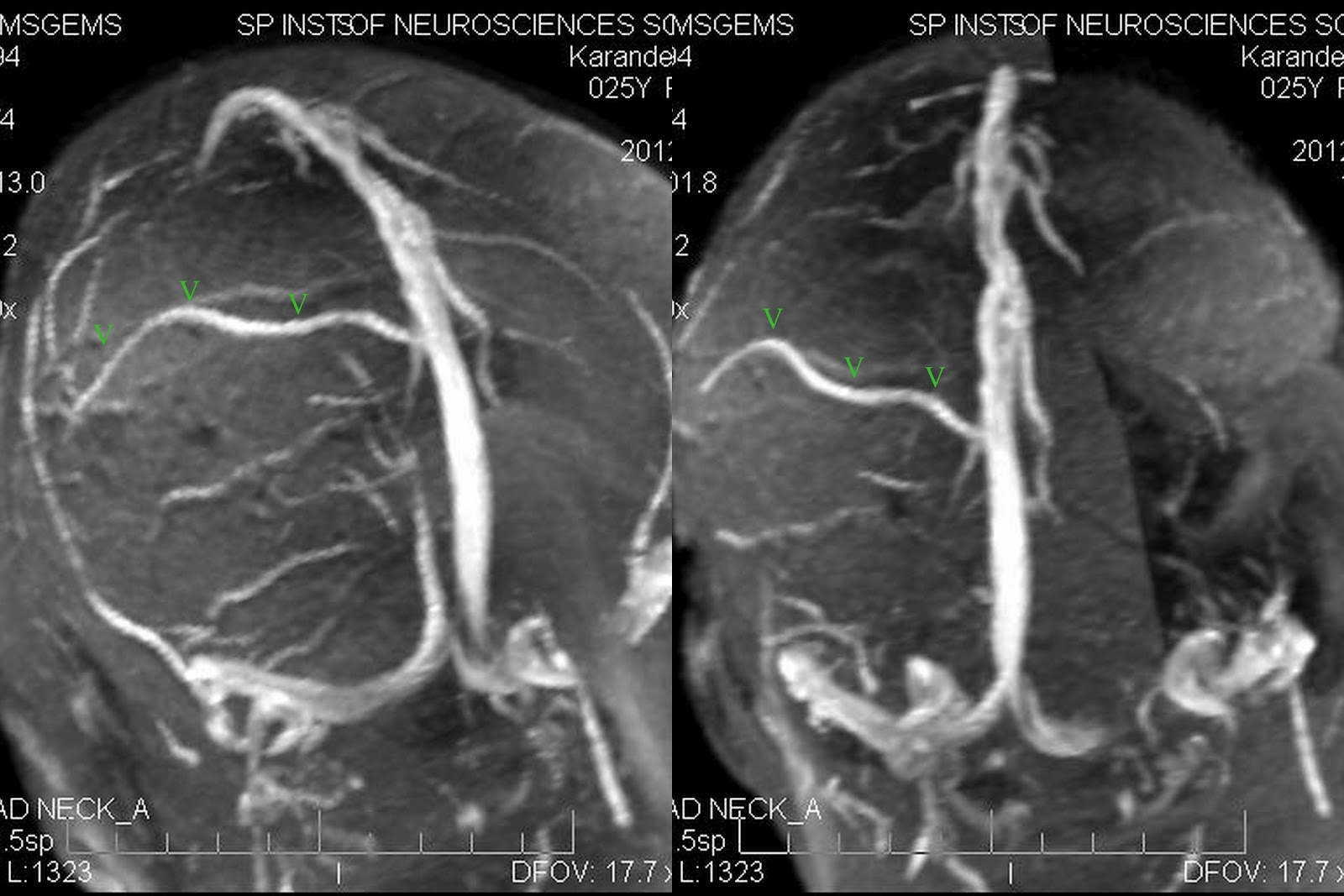 Dr Balaji Anvekar FRCR: 01/03/12 - 01/04/12